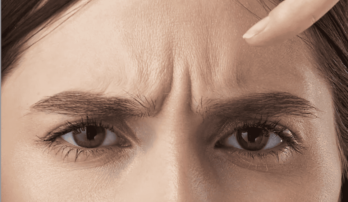 Frown Lines | Adelaide - Advanced Cosmetic Medicine